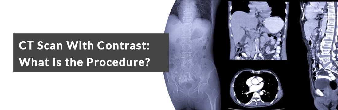 What is the Procedure of CT Scan With Contrast | Ganesh Diagnostic