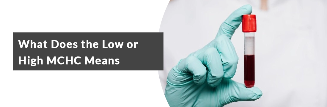 What Does the Low or High MCHC Means | Ganesh Diagnostic