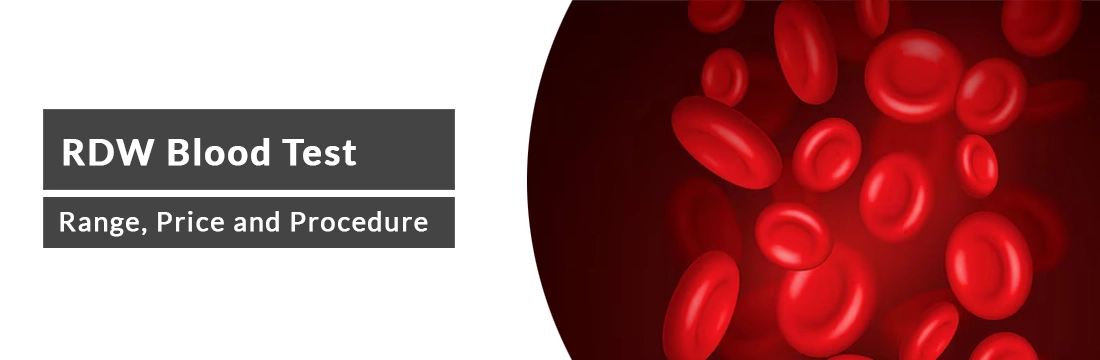 RDW Blood Test: Range, Price and Procedure | Ganesh Diagnostic