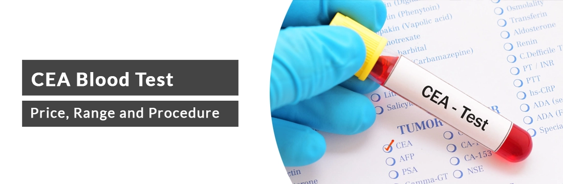 CEA Blood Test: Price, Range and Procedure | Ganesh Diagnostic