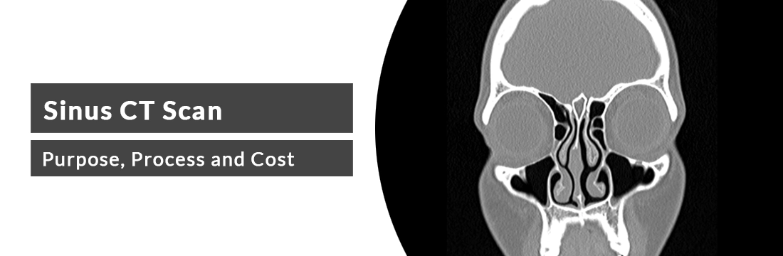 Purpose and Cost of Sinus CT Scan | Ganesh Diagnostic