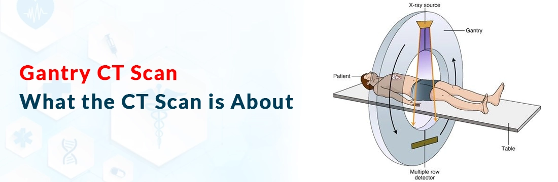 Gantry CT Scan: What the CT Scan is About | Ganesh Diagnostic