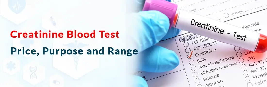 Creatinine Blood Test Price and Range