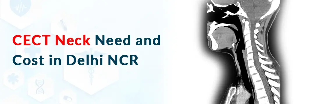 CECT Neck: Need and Cost in Delhi NCR | Ganesh Diagnostic