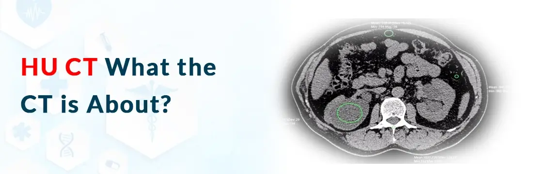 HU CT: What the CT is About? | Ganesh Diagnostic