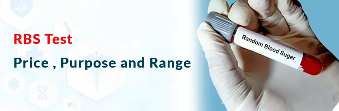 RBS Test: Price, Purpose and Range | Ganesh Diagnostic