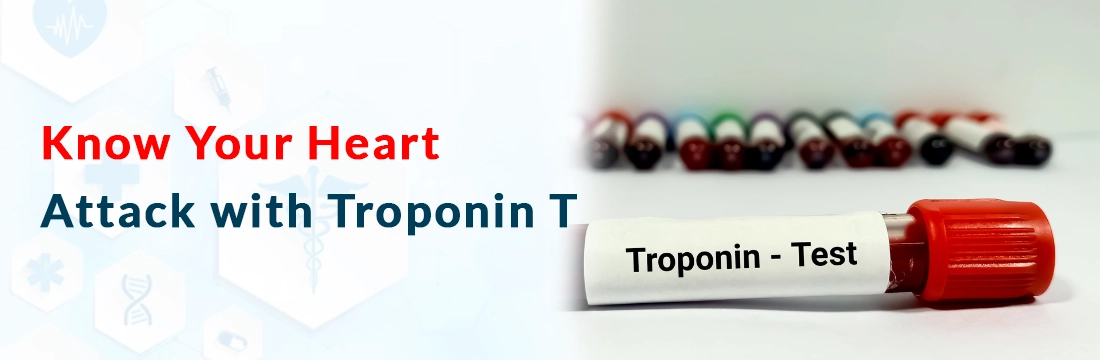 Know Your Heart Attack with Troponin T | Ganesh Diagnostic