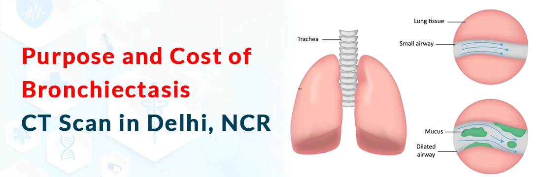 Purpose and Cost of Bronchiectasis CT Scan in Delhi, NCR | Ganesh ...