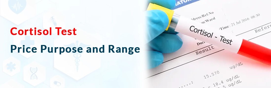 Cortisol Test: Price Purpose and Range | Ganesh Diagnostic