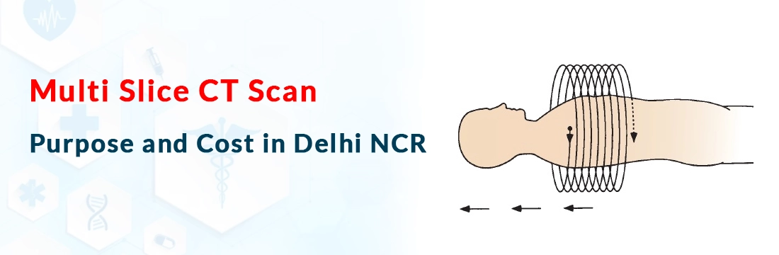 Purpose and Cost of Multi Slice CT Scan in Delhi NCR | Ganesh Diagnostic