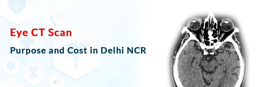 Eye CT Scan Purpose and Cost in Delhi NCR | Ganesh Diagnostic