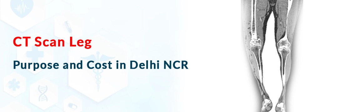 Purpose and Cost of CT Scan Leg in Delhi NCR