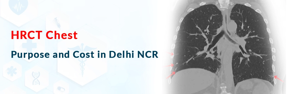 Purpose and Cost of HRCT Chest Scan | Ganesh Diagnostic