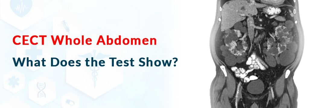 What Does CECT Whole Abdomen Test Show | Ganesh Diagnostic