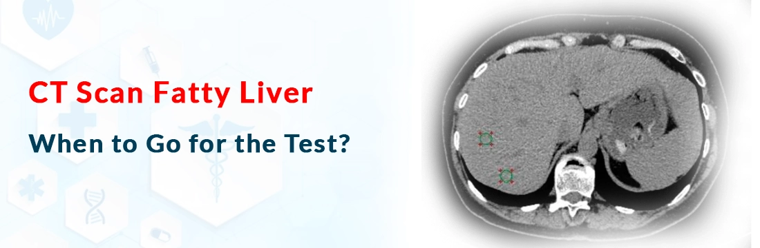 When to Go for Fatty Liver CT Scan Test | Ganesh Diagnositc