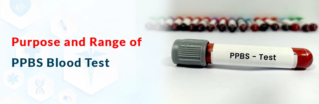 Purpose and Range of PPBS Blood Test | Ganesh Diagnostic
