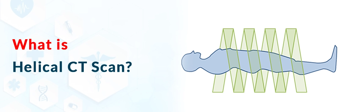 What is Helical CT Scan | Ganesh Diagnostic