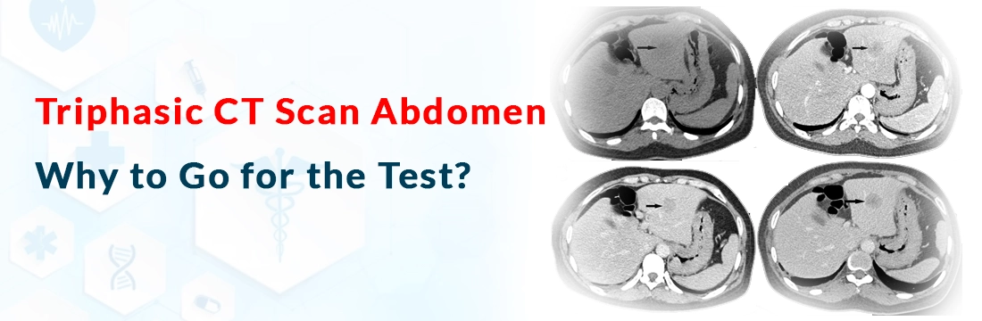 Why Should Go For Triphasic CT Scan Abdomen | Ganesh Diagnostic