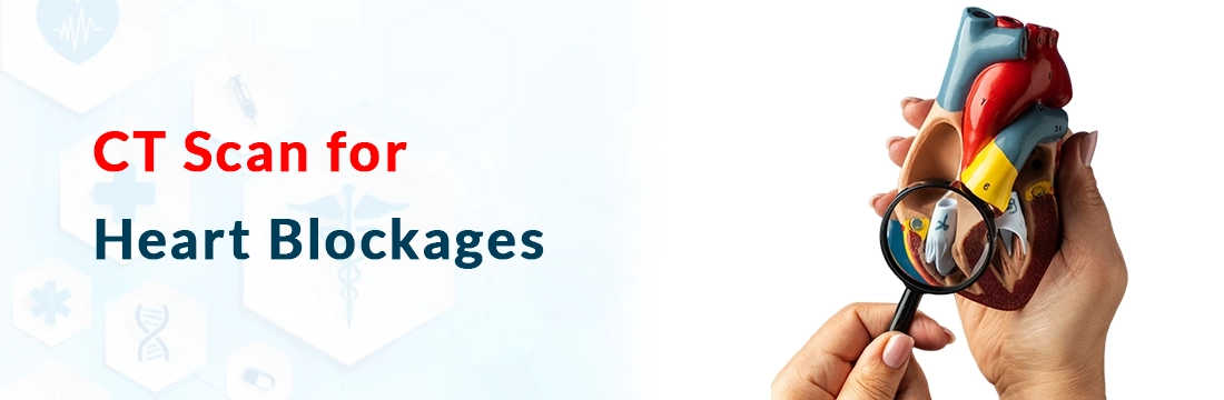 CT Scan for Heart Blockages | Ganesh Diagnostic