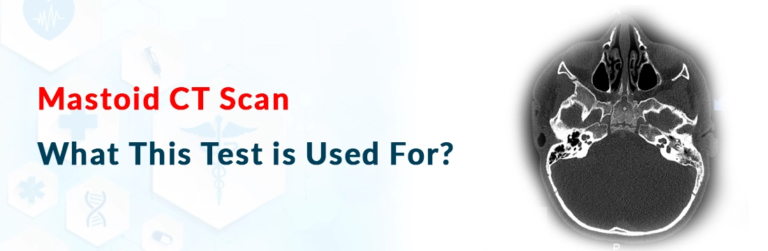 Mastoid CT Scan: What This Test is Used For | Ganesh Diagnostic