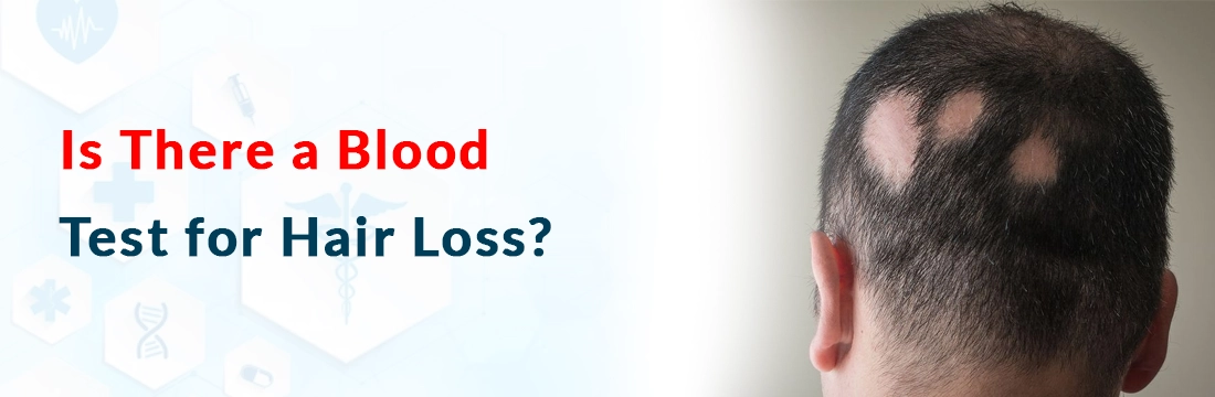 HbA1c Test in Hindi | HbA1c टेस्ट: उपयोग, लक्ष्य स्तर और प्रक्रिया