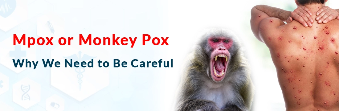 Mpox or Monkey Pox: Why We Need to Be Careful