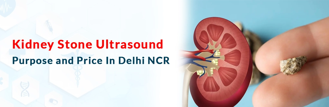 Kidney stone ultrasound: Purpose and Price in Delhi NCR.