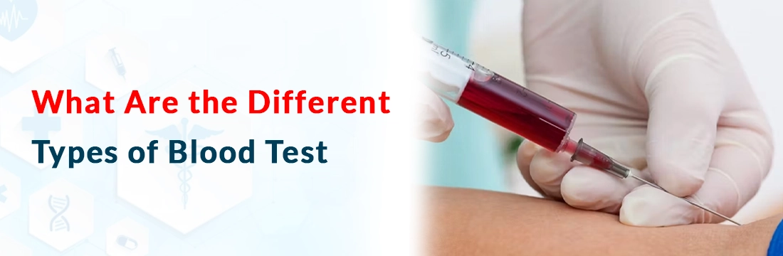 What Are the Different Types of Blood Test