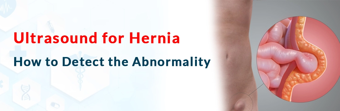 Ultrasound for Hernia, How to Detect the Abnormality | Ganesh Diagnostic