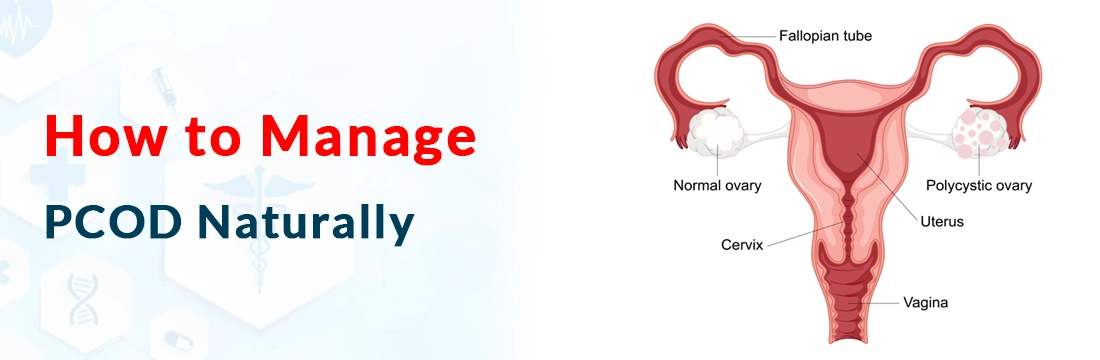 How to Manage PCOD Naturally | Ganesh Diagnostic