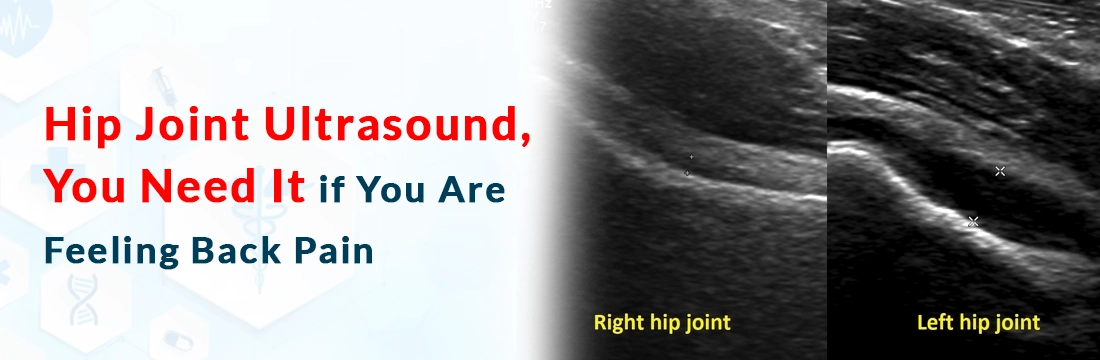 Hip Joint Ultrasound, You Need It, if You Are Feeling Back Pain ...