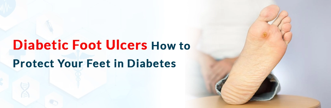 Diabetic Foot Ulcers: How to Protect Your Feet in Diabetes