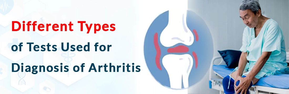Different Types of Tests Used for Diagnosis of Arthritis