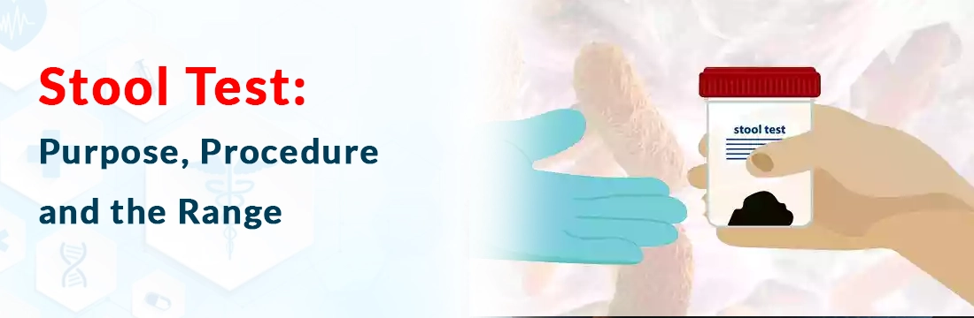 Stool Test: Purpose, Procedure, and the Range | Ganesh Diagnostic