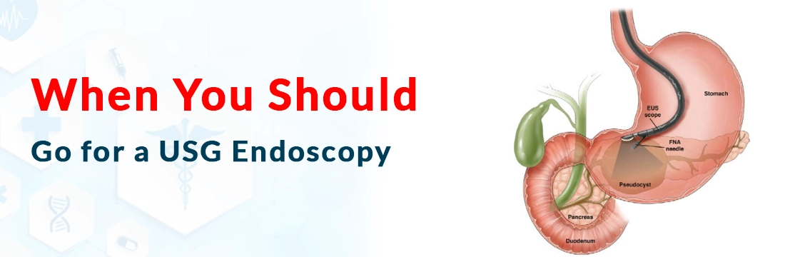 When You Should Go for a USG Endoscopy | Ganesh Diagnostic