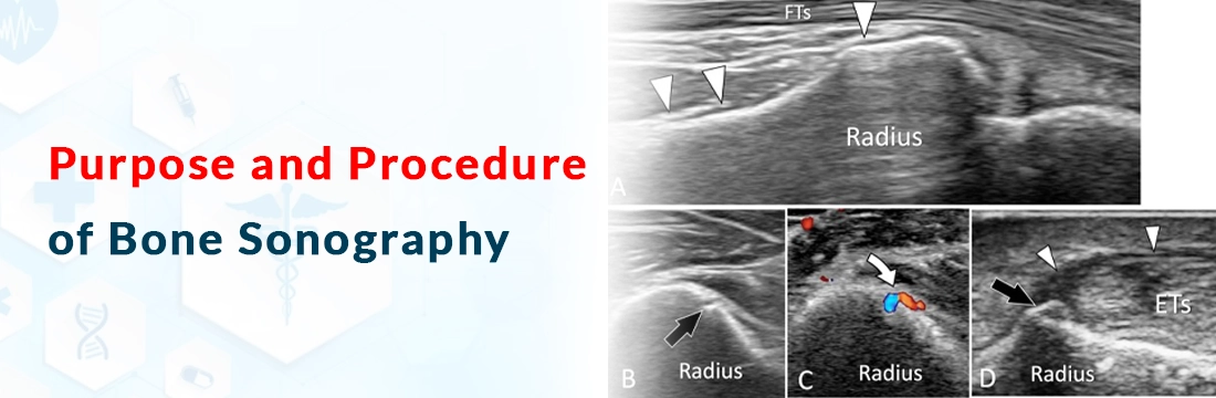 Purpose and Procedure of Bone Sonography | Ganesh Diagnostic