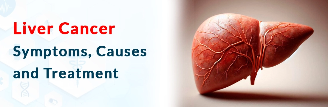 Liver Cancer: Symptoms, Causes and Treatment | Ganesh Diagnostic