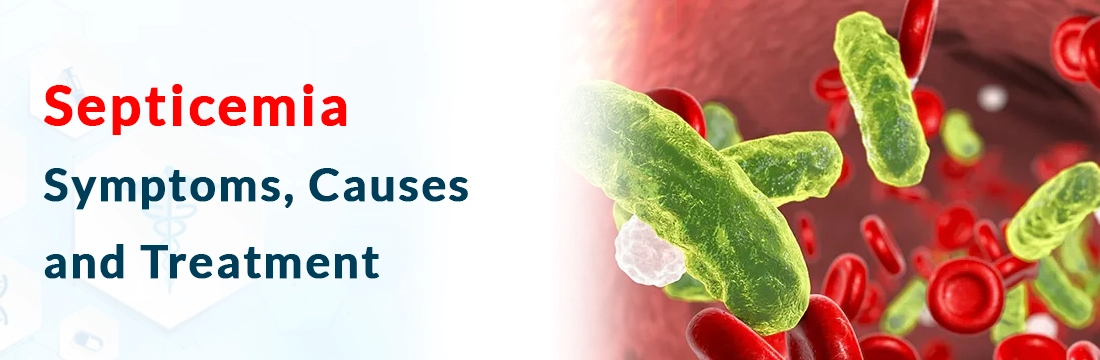 Septicemia: Symptoms, Causes and Treatment | Ganesh Diagnostic