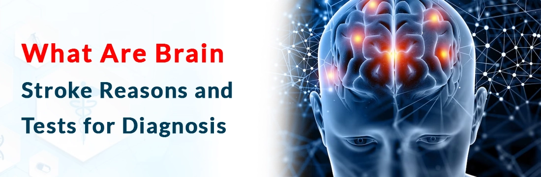 What Are Brain Stroke Reasons and Tests for Diagnosis | Ganesh Diagnostic