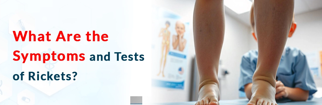 What Are the Symptoms and Tests of Rickets | Ganesh Diagnostic
