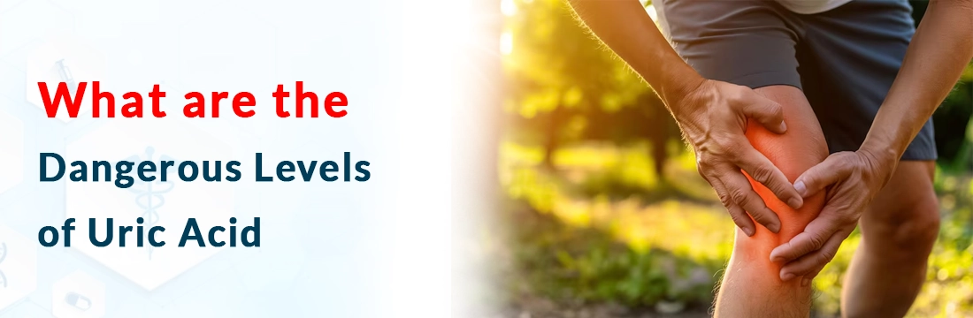 What are the Dangerous Levels of Uric Acid | Ganesh Diagnostic