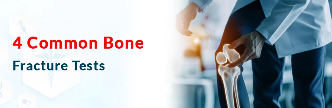 4 Common Bone Fracture Tests | Ganesh Diagnostic
