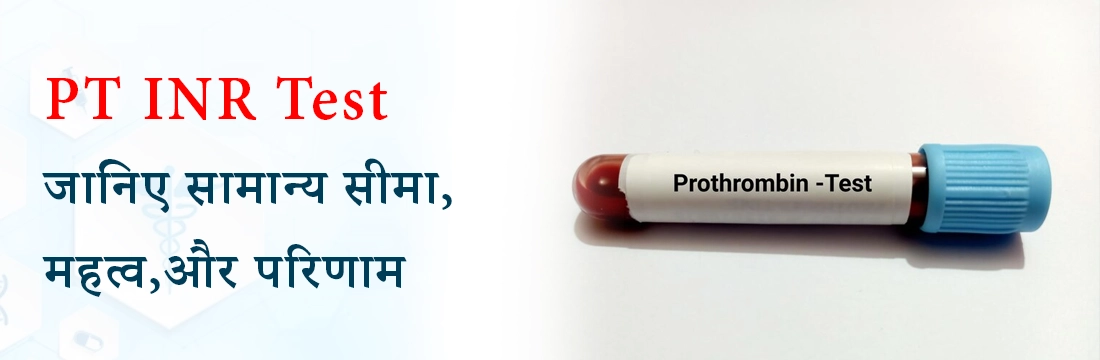 PT INR Test in Hindi - जानिए सामान्य सीमा, महत्व, और परिणाम