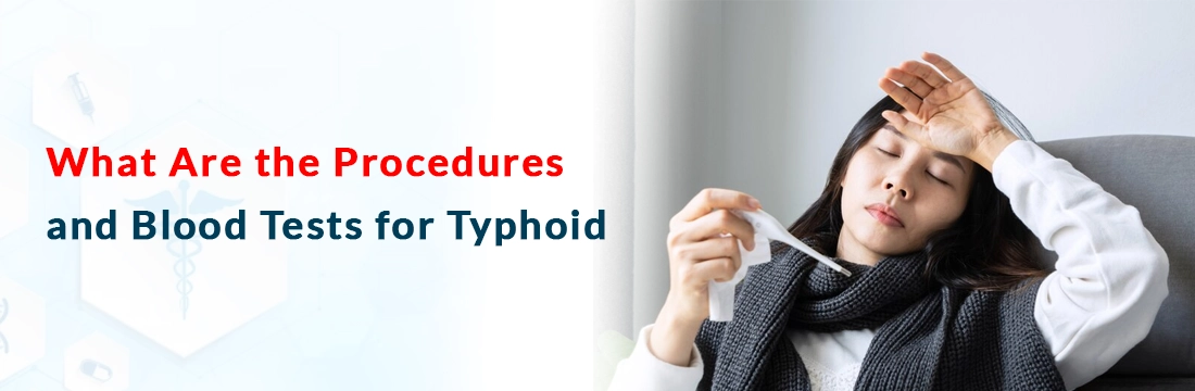 What Are the Procedures and Blood Tests for Typhoid | Ganesh Diagnostic