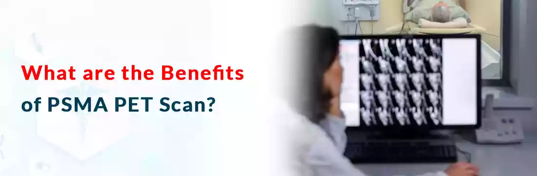 What are the Benefits of PSMA PET Scan? | Ganesh Diagnostic