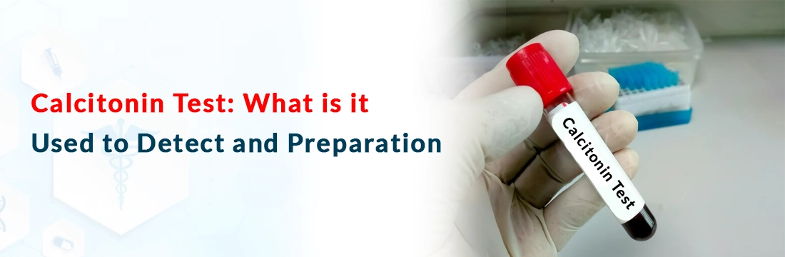 Calcitonin Test: What is it Used to Detect and Preparation | Ganesh ...