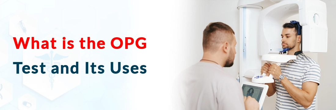 What is the OPG Test and Its Uses | Ganesh Diagnostic