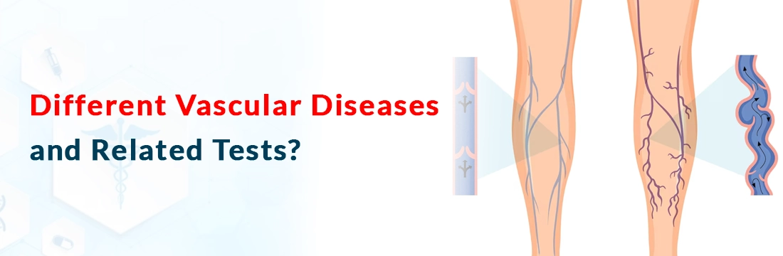 Different Vascular Diseases and Related Tests | Ganesh Diagnostic
