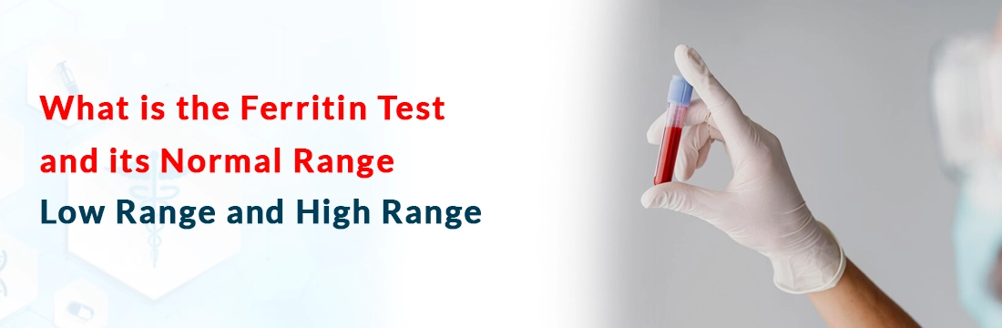 Ferritin Test and its Normal Range, Low Range and High Range