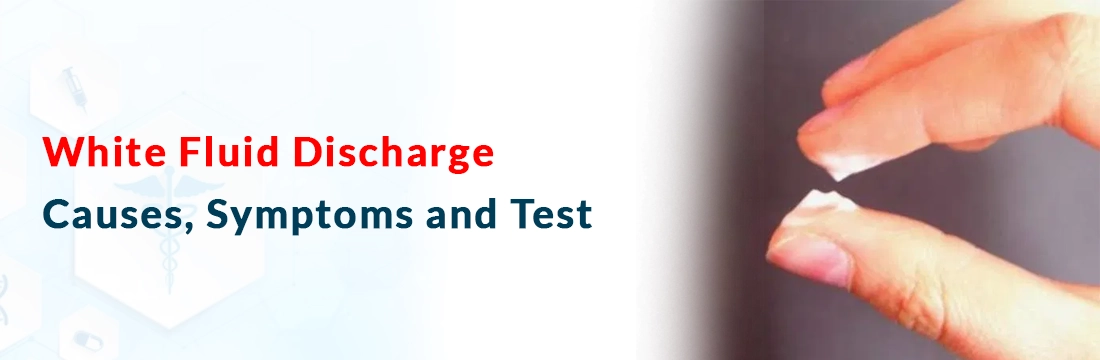 White Fluid Discharge: Causes, Symptoms and Test